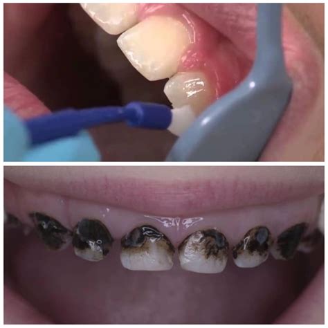 ☎️77197788 Цагаан түрхлэг Этик шүд эрүү нүүрний эмнэлэг