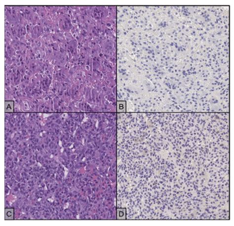 A The Lesion Is Composed By Multinucleated And Mononuclear Cells Hande Download Scientific