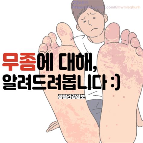 발톱무좀 치료 무좀 원인과 증상 네이버 블로그