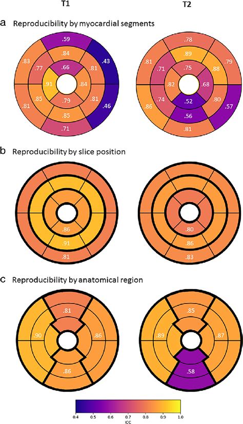Polar Maps Of Reproducibility Intraclass Correlation Coefficients Are Download Scientific