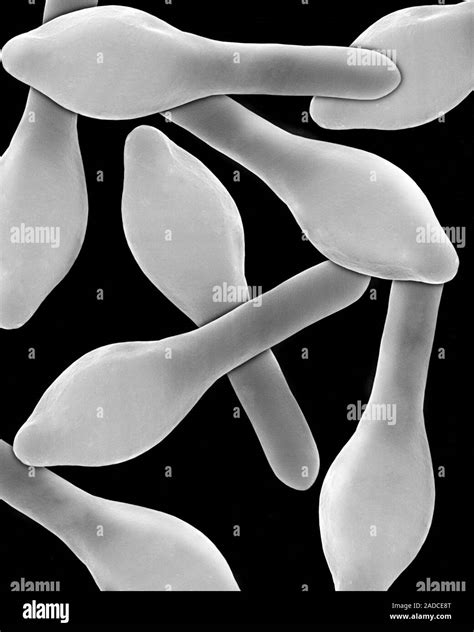 Scanning Electron Micrograph Sem Of Clostridium Botulinum Spores Gram Positive Endospore