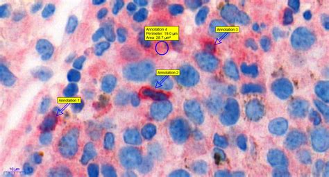 How To Detect Nuclei With Different Staining Issue 83 Qupath