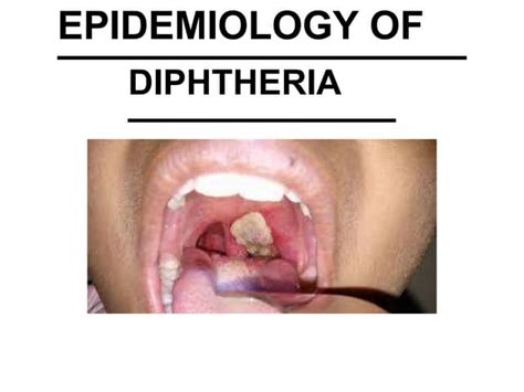 Diptheria Finalpptx