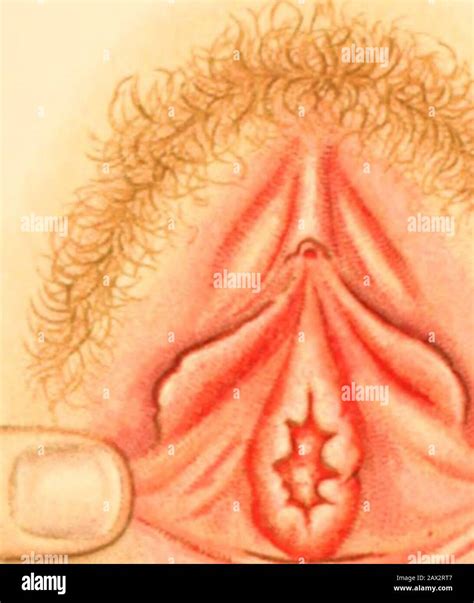 A Textbook Of Obstetrics Means An Infallible One It Is Oftenabsent Altogether In Early