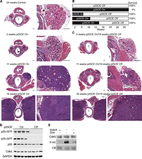 The Role Of Cdk5 In Neuroendocrine Thyroid Cancer Cancer Cell