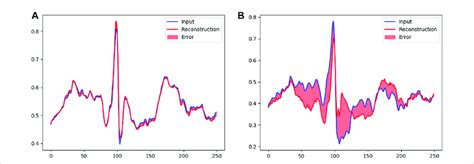 Reconstruction Of Ecg Data A Normal And B Abnormal Download