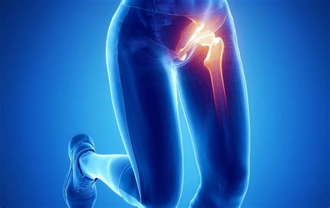 사타구니 통증 원인 및 치료 방법 왼쪽 오른쪽 허벅지 안쪽 가랑이 서혜부 통증 네이버 포스트