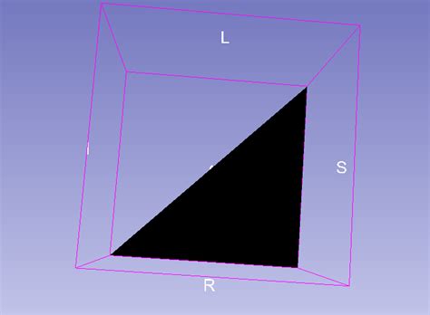 Problem Loading Stl File Support 3d Slicer Community