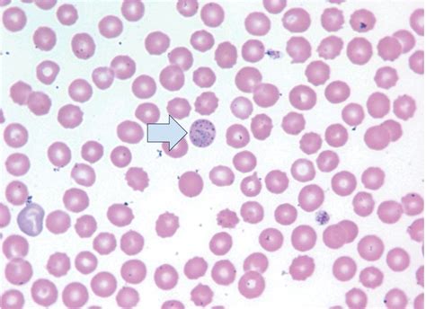 5 Eritrocitos Inclusiones Patología Clínica Veterinaria