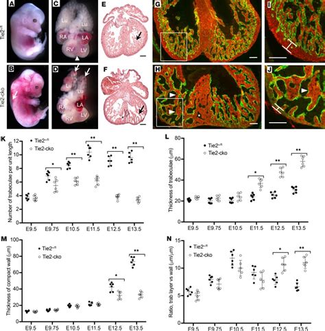 Tie2 Regulates Endocardial Sprouting And Myocardial Trabeculation Pmc
