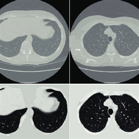 3d Multi Scale Pulmonary Nodule Detection Networks The Ct Images In