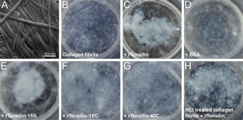 Dermis Collagen Fibrils And Aggregation Assays A Sem Photograph Of