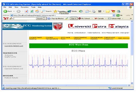 Remote Electrocardiogram Monitoring Based On The Internet Computer