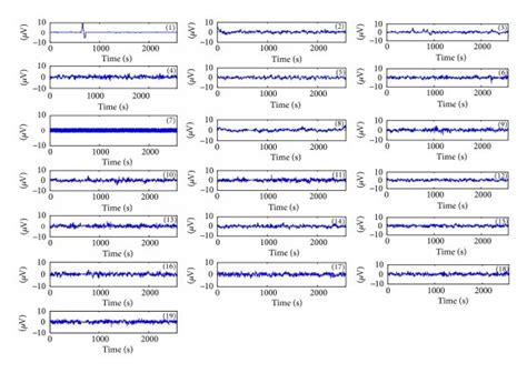 Separated Signals By Esbss Algorithm Download Scientific Diagram