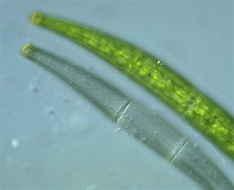 Protist Images Closterium Intermedium