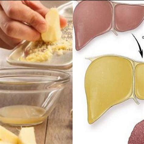 Ще се отървете от омазнен черен дроб и ще отслабнете с това 3 дневно лечение За Жената