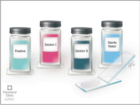 Sperm Morphology Assessment In The Era Of Intracytoplasmic Sperm Injection Reliable Results