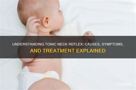 Understanding Tonic Neck Reflex Causes Symptoms And Treatment