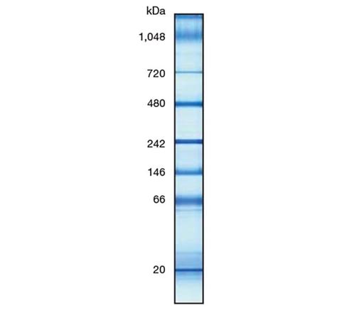 Unstained Protein Gel Ladder At Robyn Huff Blog