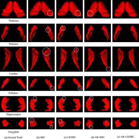 3d Segmentation Results Of Each Subcortical Structure On Ibsr Download Scientific Diagram