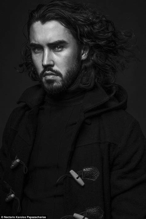 Wheelchair Model Hallam Chitty Fell From A Tree And Became A