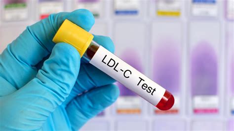 Service For Testing The Efficiency Of Ldl Cholesterol Production