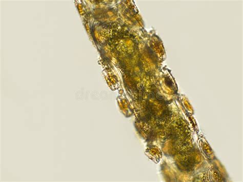 Filamentous Algae Under Microscopic View Stock Image Image Of