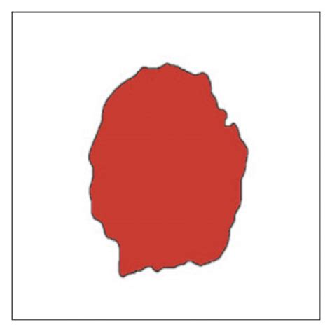 Two Sample Examples Of Skin Cancer Segmentation Based On The Proposed