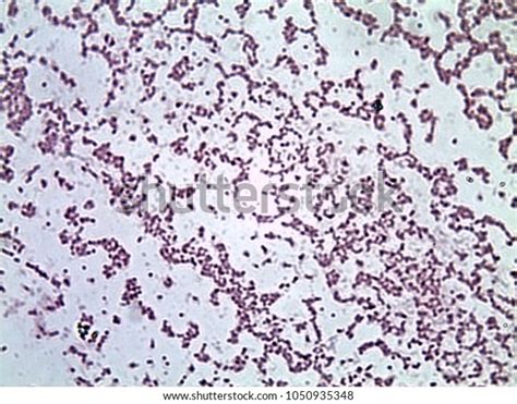 Staphylococcus Aureus Microscope