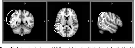 Figure 2 From Fractionating The Neural Substrates Of Incidental Recognition Memory Semantic