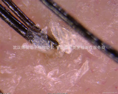500x Scalp Bacteria Scope（20m Pixels） Cbs 605 Cbs China