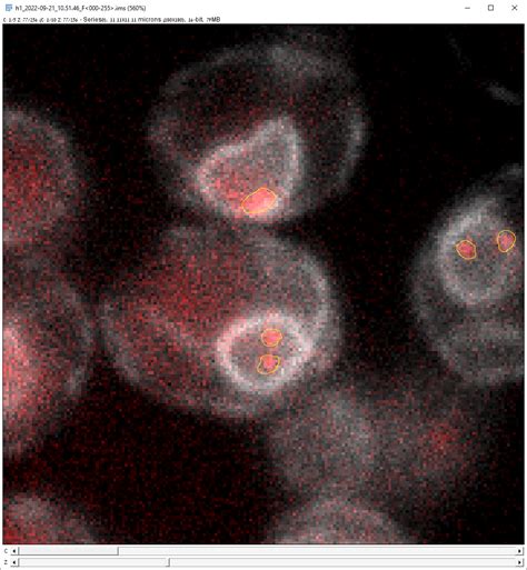 Stardist For Spots Image Analysis Imagesc Forum