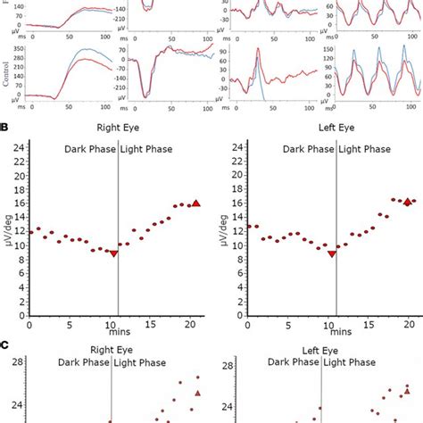 Electrooculogram And Full Field Electroretinogram Testing Results From