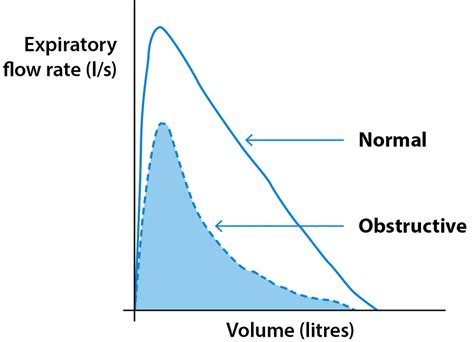 Spirometry Test Spirometry Results And Spirometry Interpretation