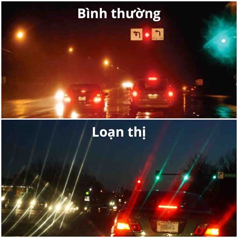 Tổng Hợp Những Nguyên Nhân Gây Loạn Thị ở Người Trẻ