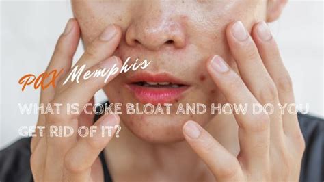 Coke Bloat Face Before And After