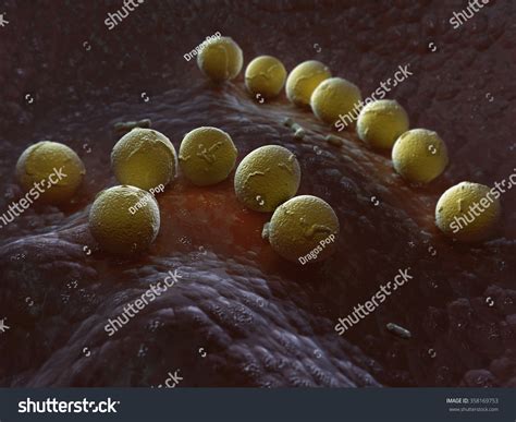 Streptococcus Pyogenes Infection Stock Photo Shutterstock