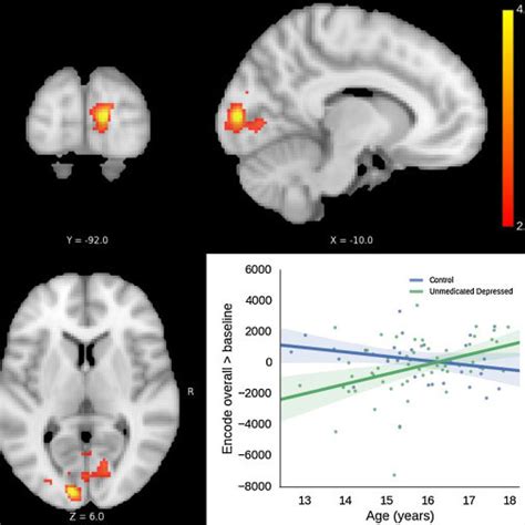 Bold Activation During Encoding Attempt All Words Baseline Where Download Scientific Diagram