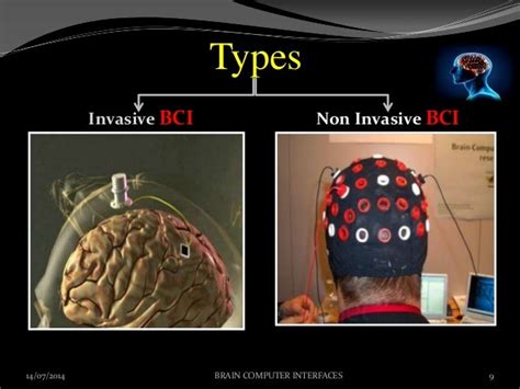 brain computing interface