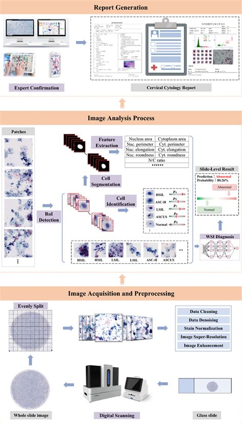 The Overall Process Of Automated Cervical Cytology Screening Download Scientific Diagram
