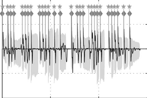 Events In An Example Stimulus The Waveform Is Plotted In Grey And The