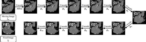 【论文笔记】递归级联网络（recursive Cascaded Networks）论文及vtn（volume Tweening Network） Csdn博客