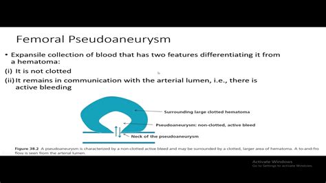 Femoral Access Cardiology Angiography Pptx