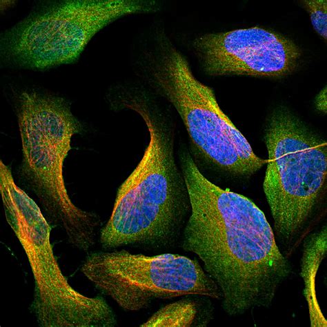 Cell Atlas Usp2 The Human Protein Atlas