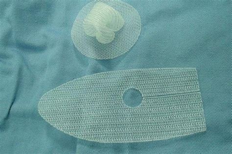 Holyrood Article National Mesh Removal Service To Be Set Up In Scotland