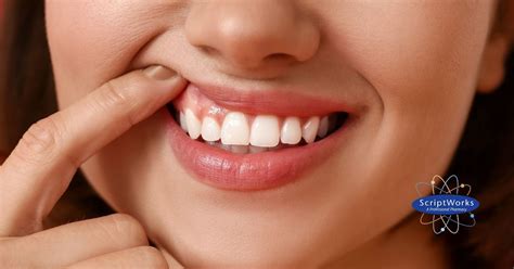 Dental Health The Perio Protect Method For Periodontal Disease