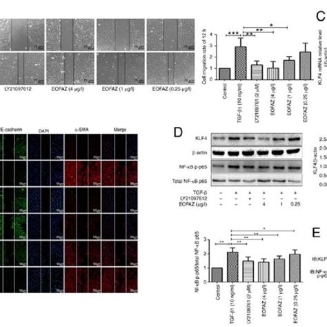 Endmt Is Induced By Tgf β1 In Huvecs A Effect Of 10 Ng Ml Tgf β1 On
