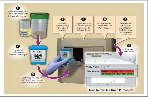 Figure 1 From Detection Of Mycobacterium Tuberculosis In Afb Smear Negative Sputum Specimens