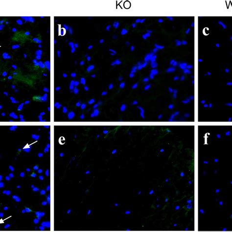 Presence Of C B In The Spinal Cord Following Spinal Cord Injury In Download Scientific