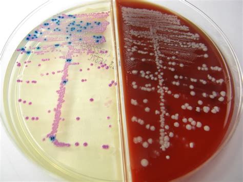 Staphylococcus Simulans Mostlyharmless Flickr Staphylococcus Simulans Mostlyharmless Flickr